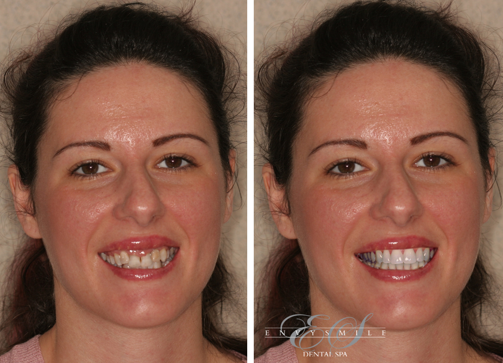 Our Latest Technology - EnvySmile Dental Spa in Brooklyn NY