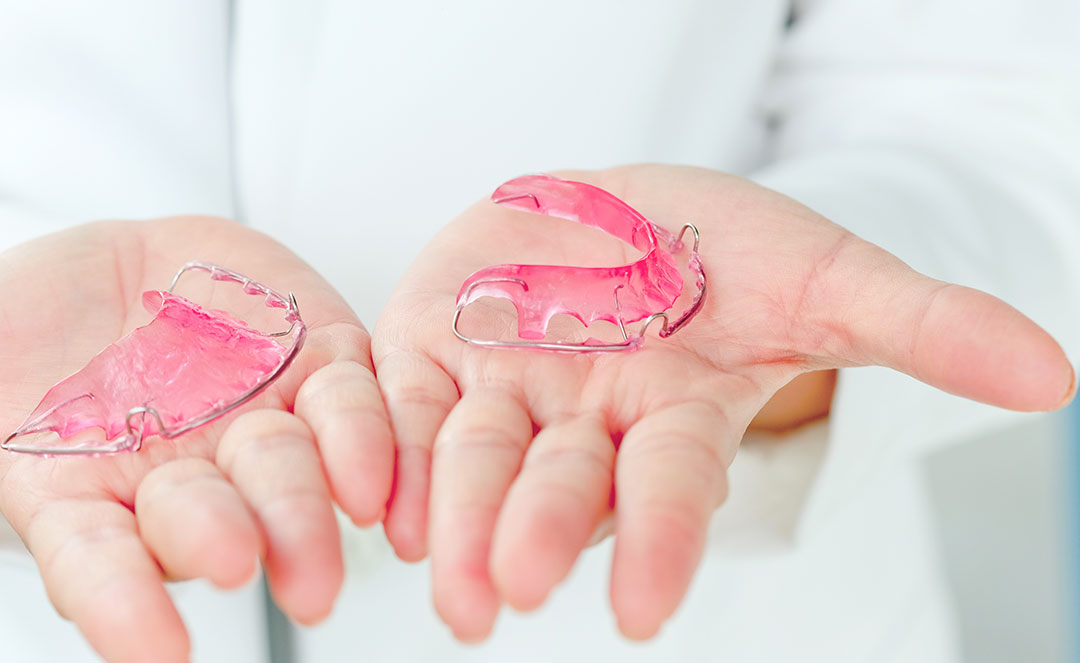 Cracked Retainer | Envy Smile Dental Spa