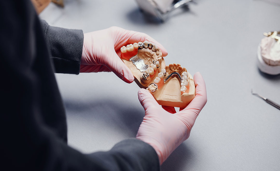 Metal Filling Removal in Brooklyn | Envy Smile Dental Spa